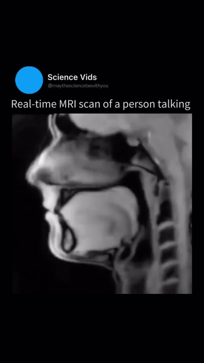 This is a real-time MRI scan of a person speaking (german). - Meme by ...