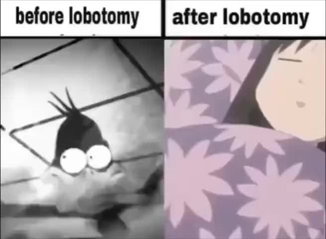I had a lobotomy tbh - Meme by ColonCancer :) Memedroid