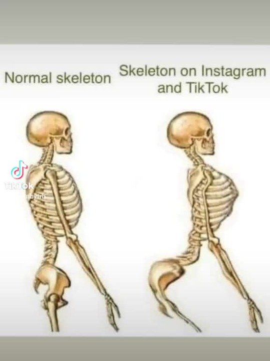 Skeles - Meme by tomby :) Memedroid